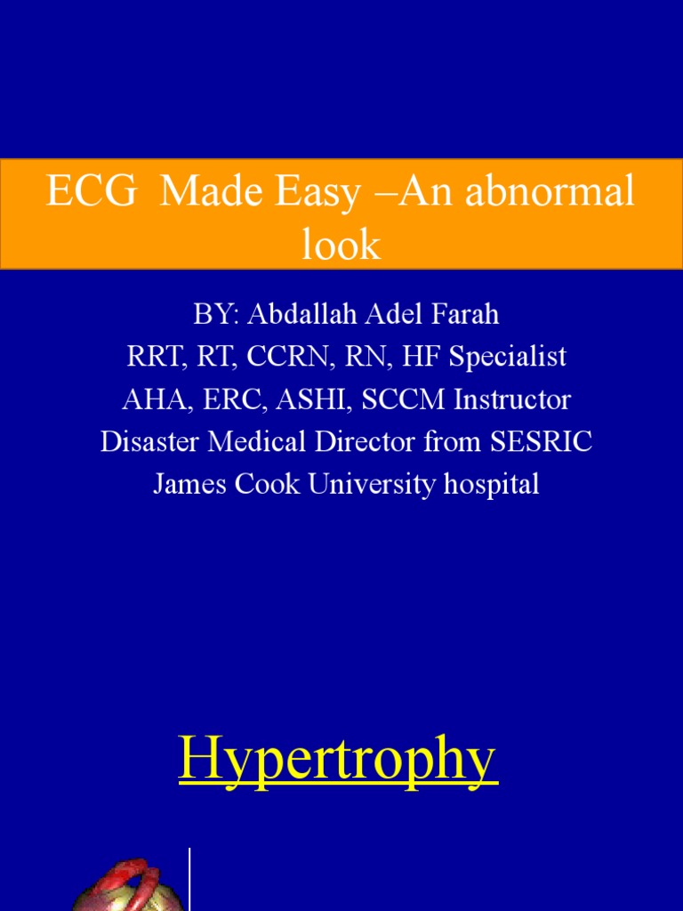 ECG Abnormalities Guide | PDF | Electrocardiography | Myocardial Infarction