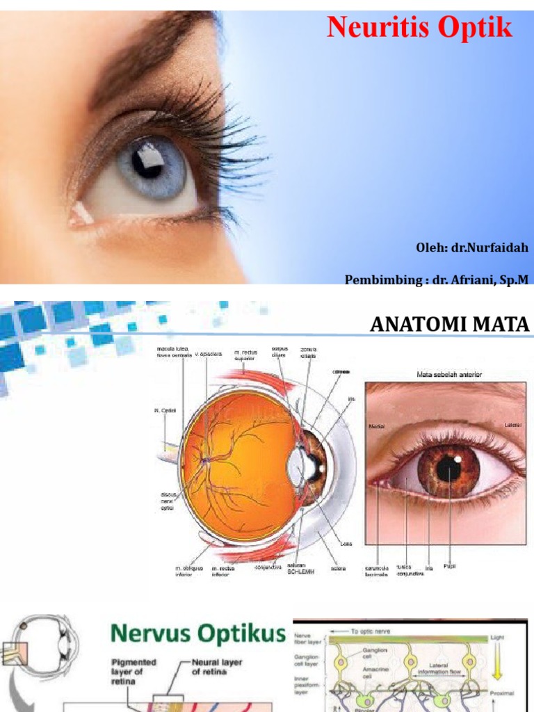 Neuritis Optic | PDF