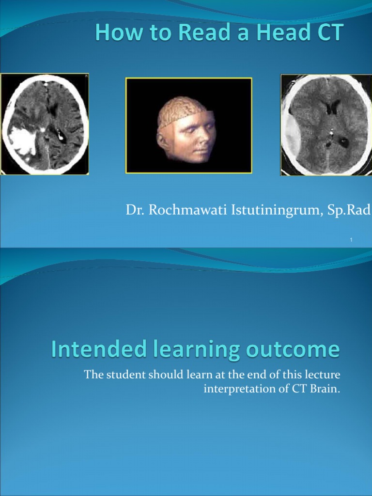 CT Brain Scan Interpretation Guide | PDF | Ct Scan | Clinical Medicine