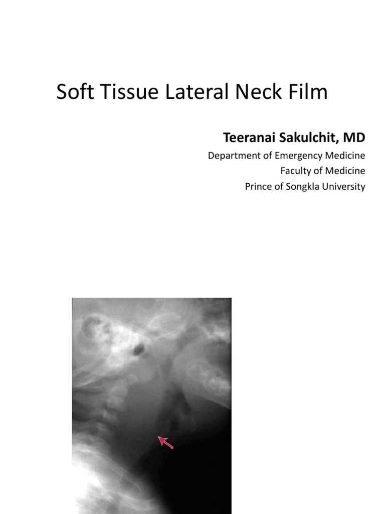 Soft Tissue Lateral Neck Film | PDF