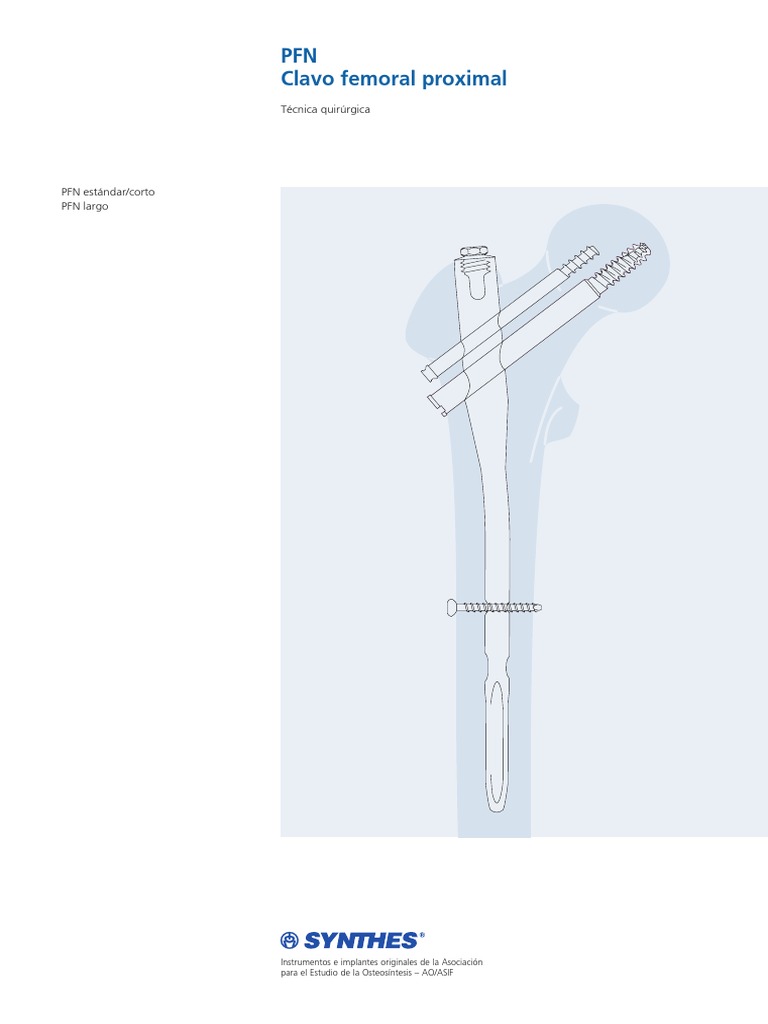 PFN Synthes | PDF | Tornillo | Sistema musculoesquelético