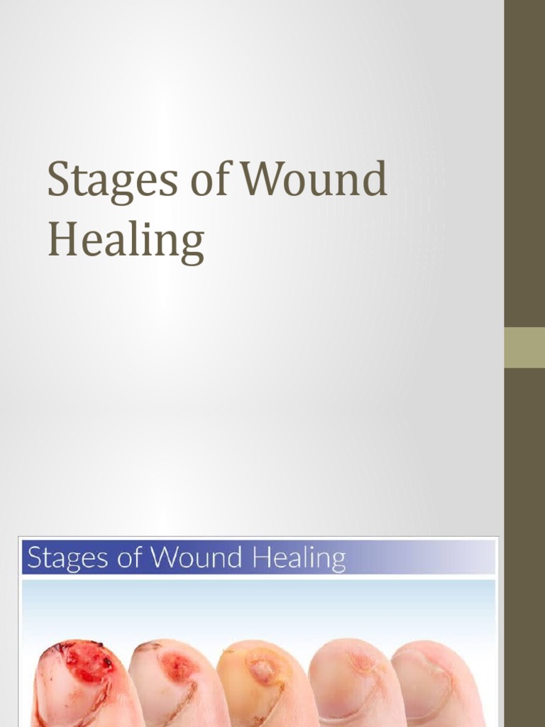 Stages of Wound Healing | PDF