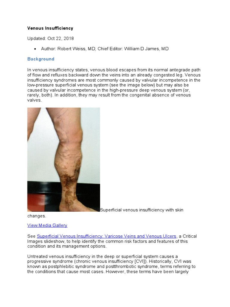 Venous Insufficiency | PDF | Varicose Veins | Vein