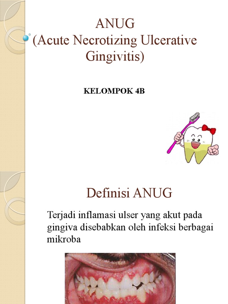ANUG | PDF