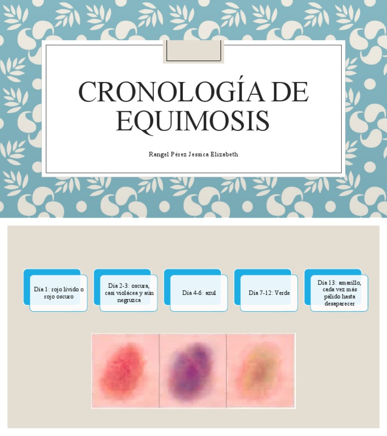 Cronología de Equimosis | PDF