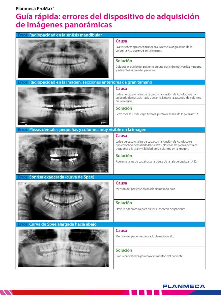 Errores Planmeca | PDF | Naturaleza
