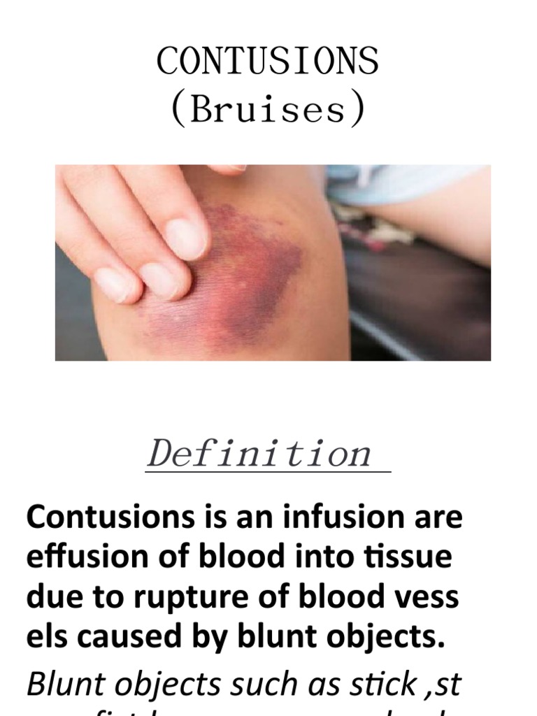 Contusions | PDF | Anatomy | Tissue (Biology)