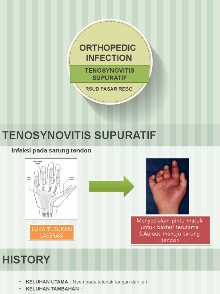 TENOSYNOVITIS | PDF