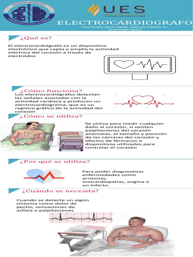 Infografia Electrocardiografo | PDF