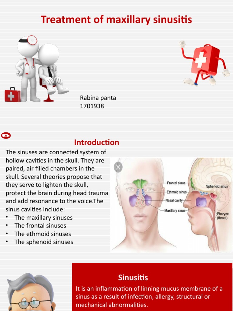 Treatment of Maxillary Sinusitis | PDF | Medical Specialties | Diseases ...