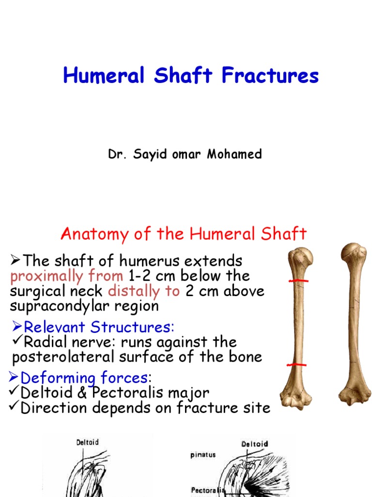 Humeral Shaft Fracture Overview | PDF