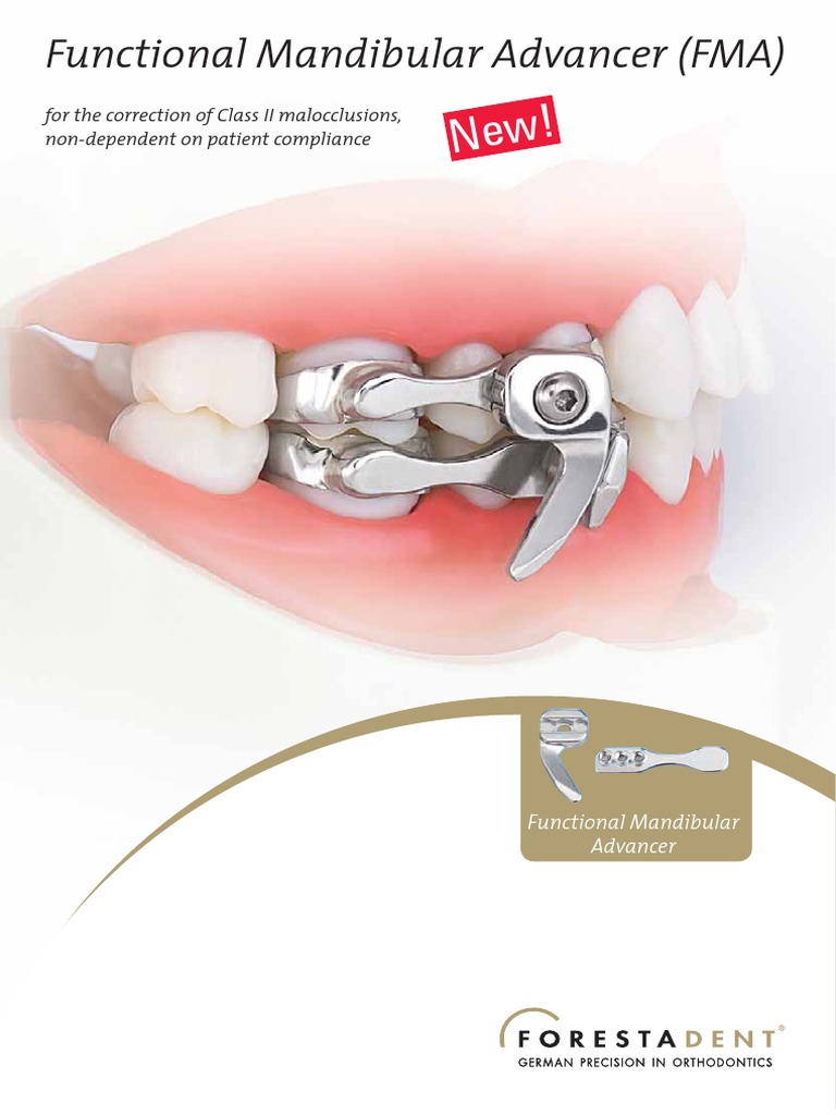 FMA Functional Mandibular Advancer (Frostadent) | PDF | Mouth | Dentistry