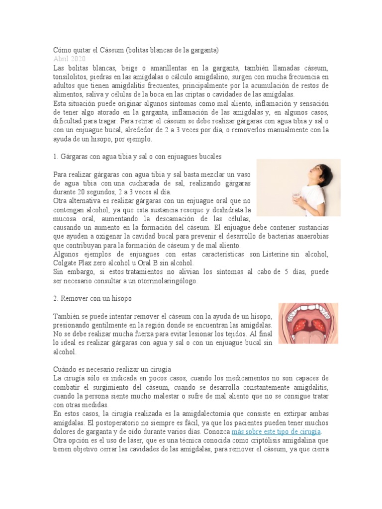Cómo eliminar el cáseum en la garganta | PDF | Epidemiología | Ciencias ...
