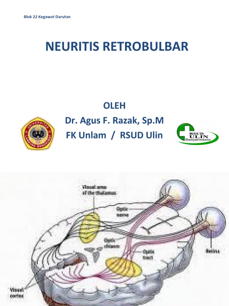 Blok 22 2018 Kegawatdaruratan NEURITIS RETROBULBAR Dr. Agus F R ...