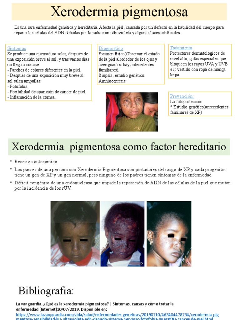 Xerodermia Pigmentosa | PDF | Cáncer | Piel
