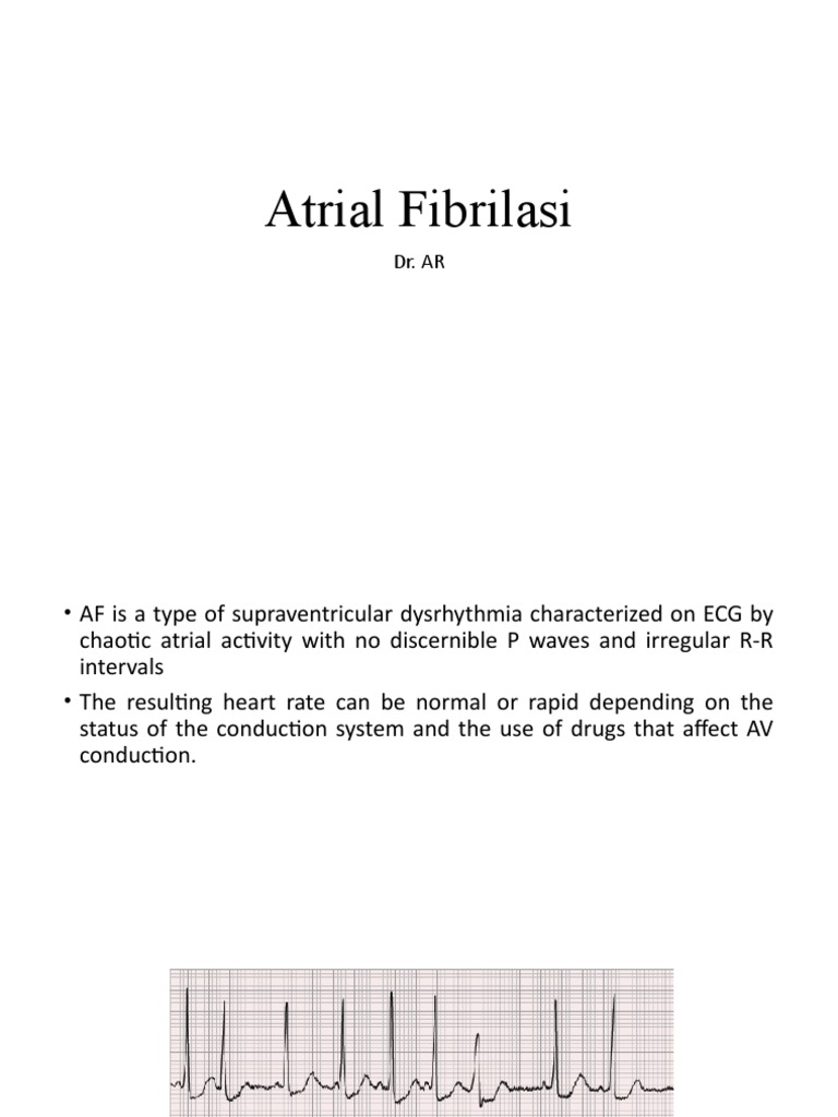 Atrial Fibrilasi Scribd | PDF | Heart | Atrium (Heart)