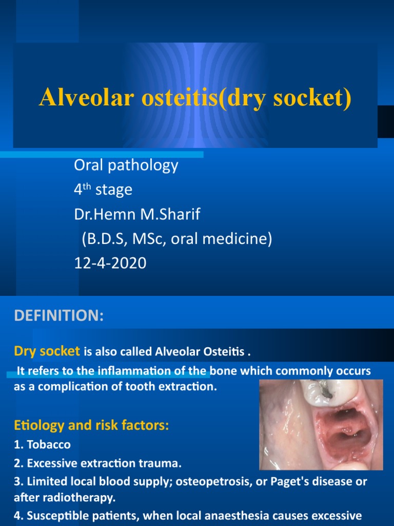 Alveolar Osteitis Radiograph