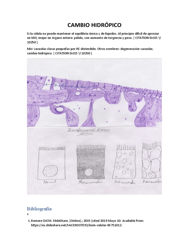 Cambio Hidrópico | PDF