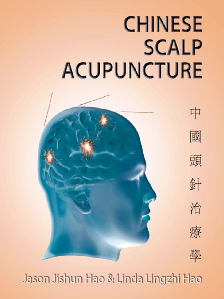 Chinese Scalp Acupuncture PDF | PDF | Cerebral Cortex | Central Nervous ...