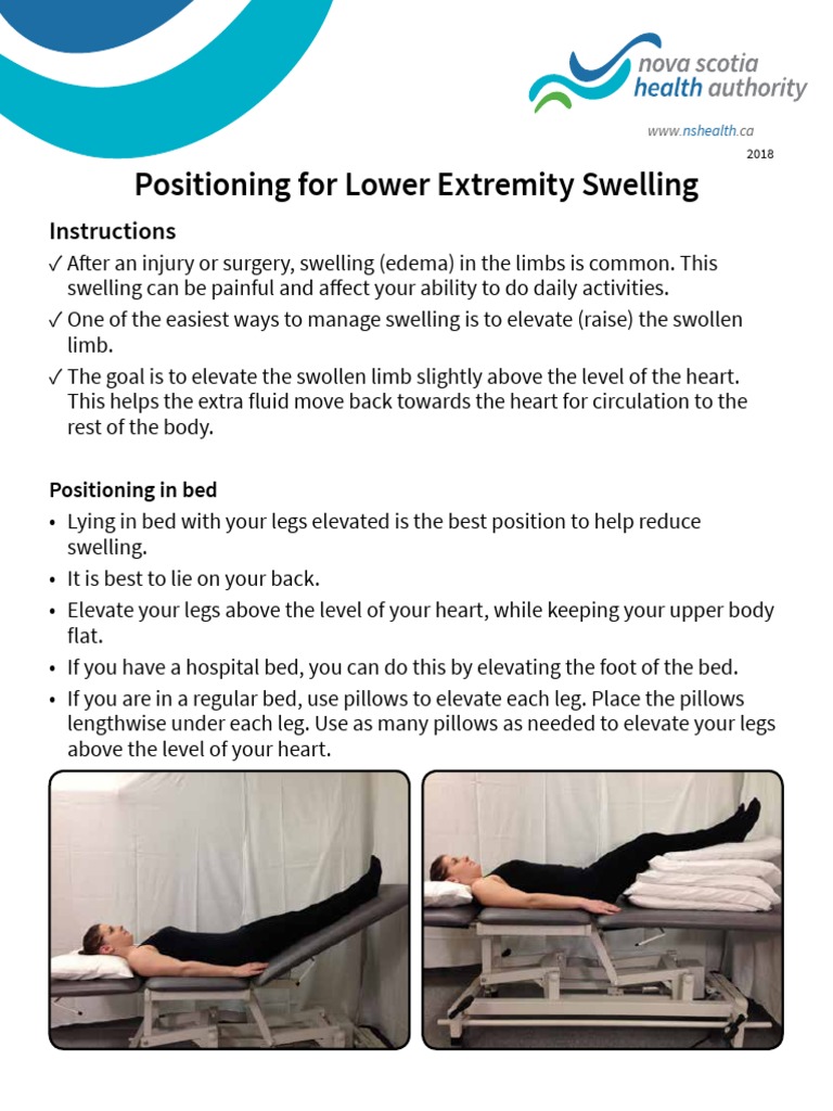 Positioning For Lower Extremity Swelling: Instructions | PDF | Edema ...
