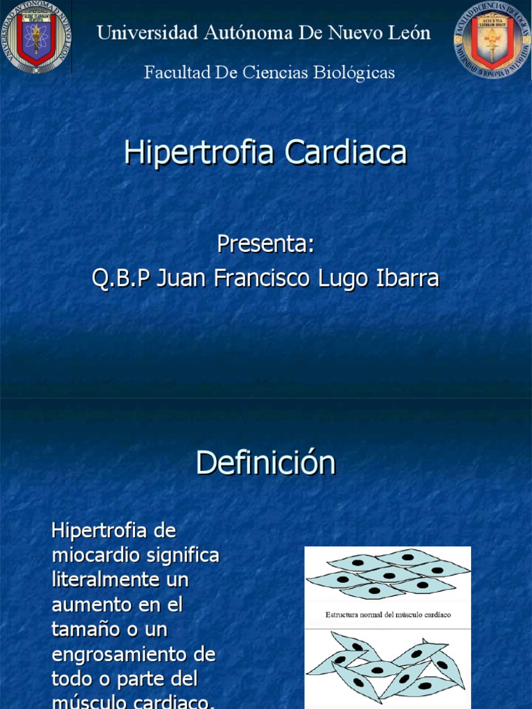 Hipertrofia Cardiaca | PDF