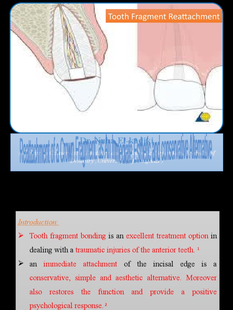 Tooth Fragment Reattachment: Dr. Nuha El-Kadiki | PDF | Dentistry | Tooth