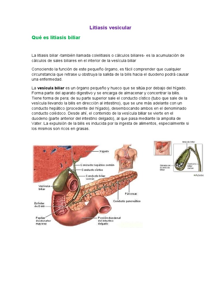 Litiasis Vesicular | PDF | Vesícula biliar | Bilis