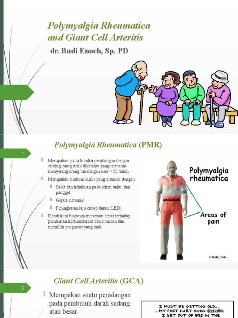 Polymyalgia Dan Giant Cell Arteritis | PDF