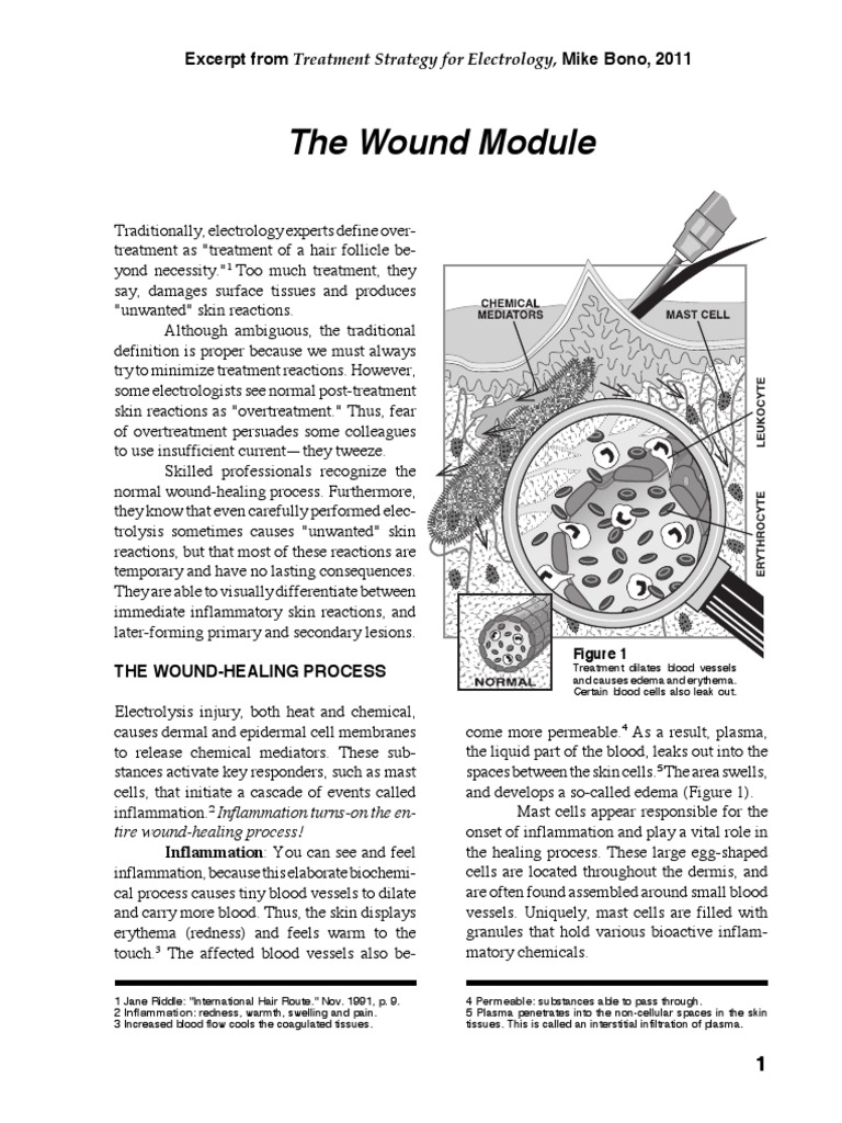 The Wound Module: Excerpt From | PDF | White Blood Cell | Macrophage