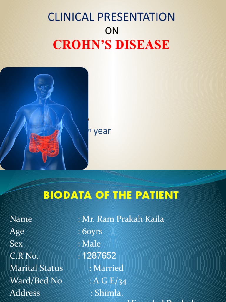 Crohns Disease Pdf Crohns Disease Gastrointestinal Tract