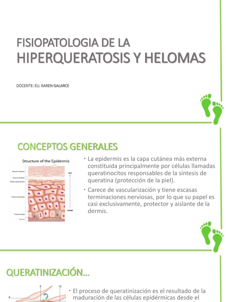 Hiperqueratosis y Helomas en Pies | PDF | Epidermis | Piel
