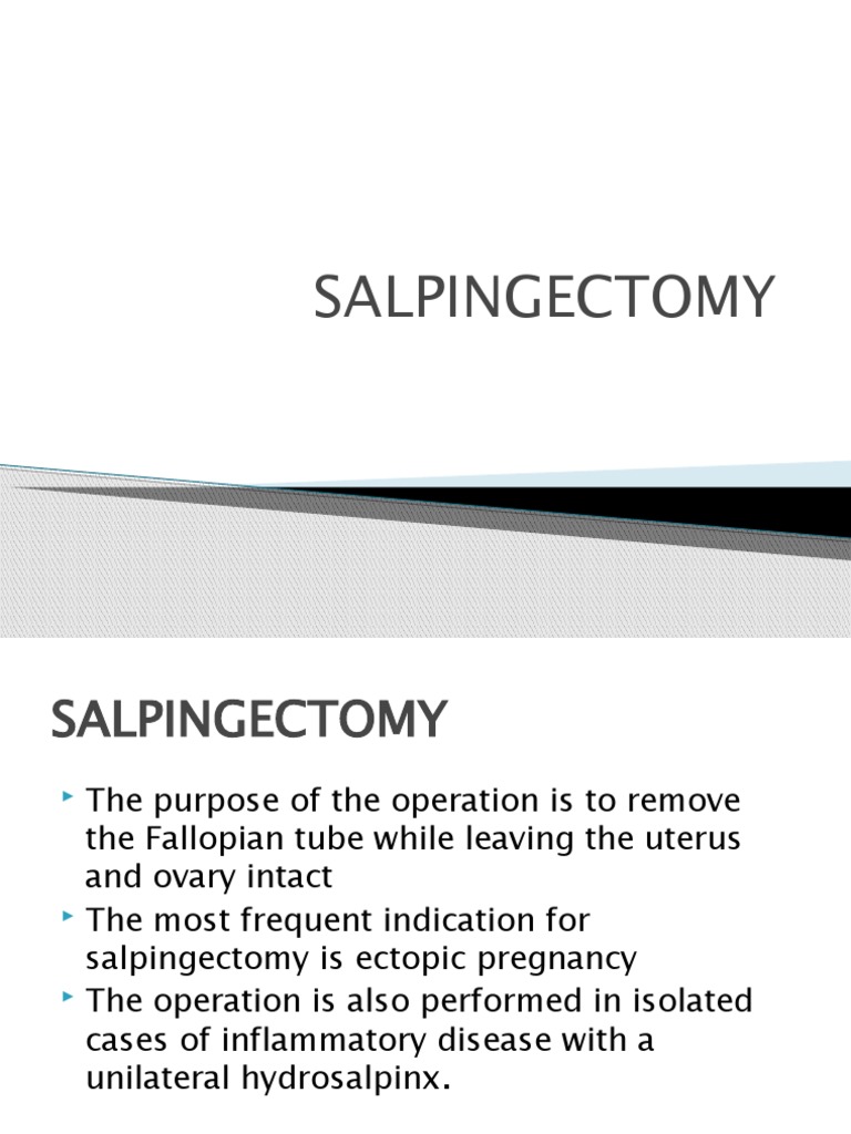 Salpingectomy | PDF