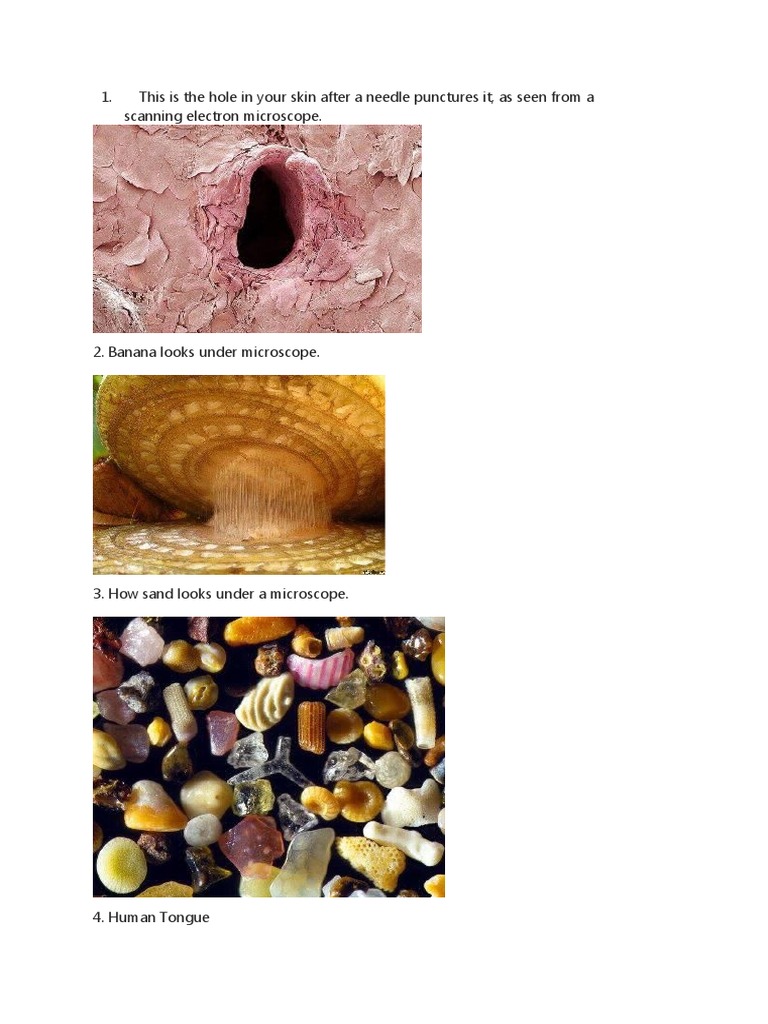 This Is The Hole in Your Skin After A Needle Punctures It, As Seen From ...