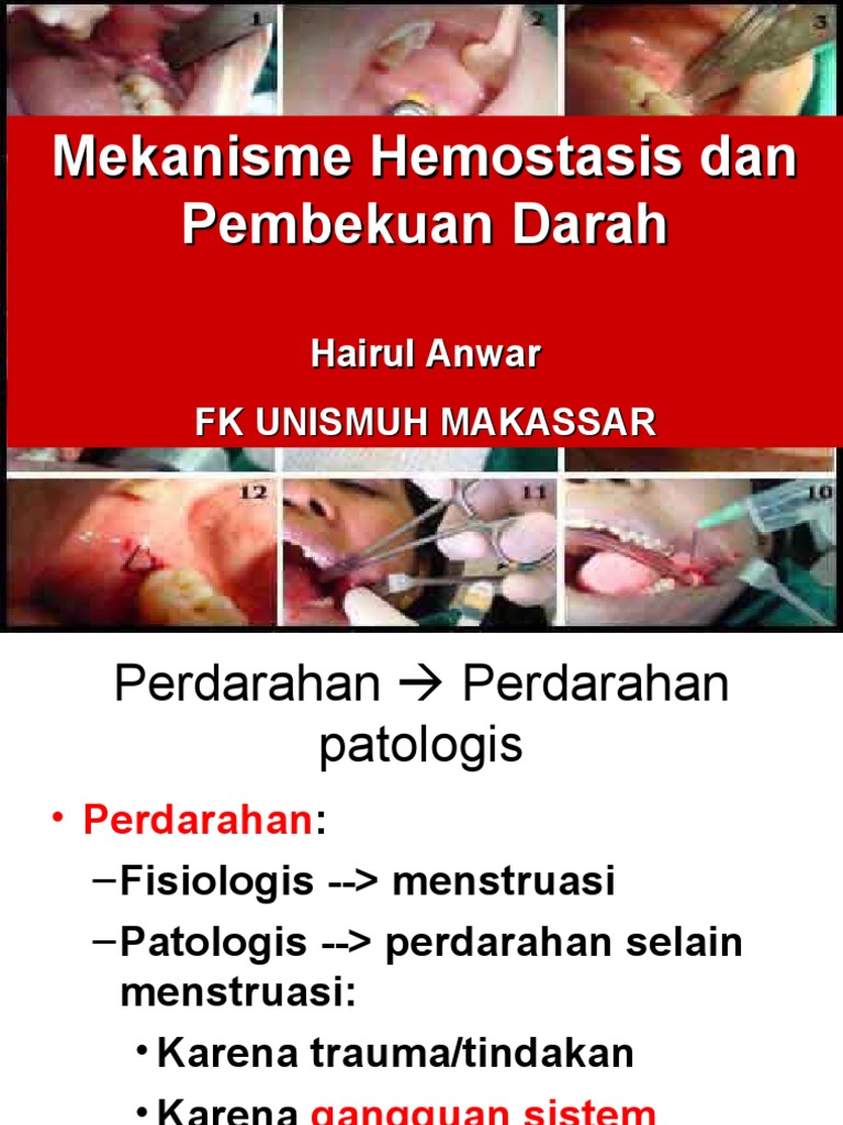 Mekanisme Hemostasis Dan Pembekuan Darah | PDF