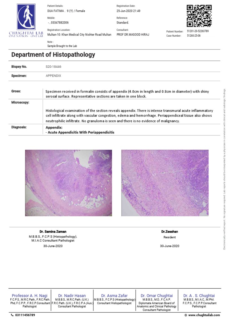 Department of Histopathology: Appendix: - Acute Appendicitis With ...