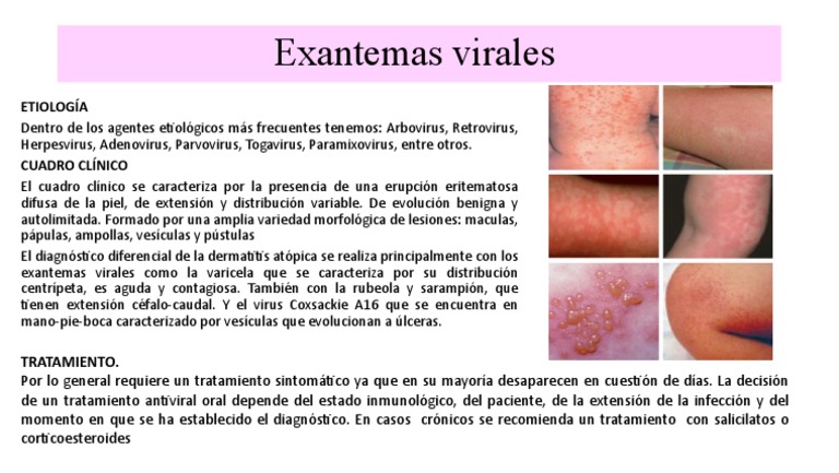 Exantema Virico | PDF