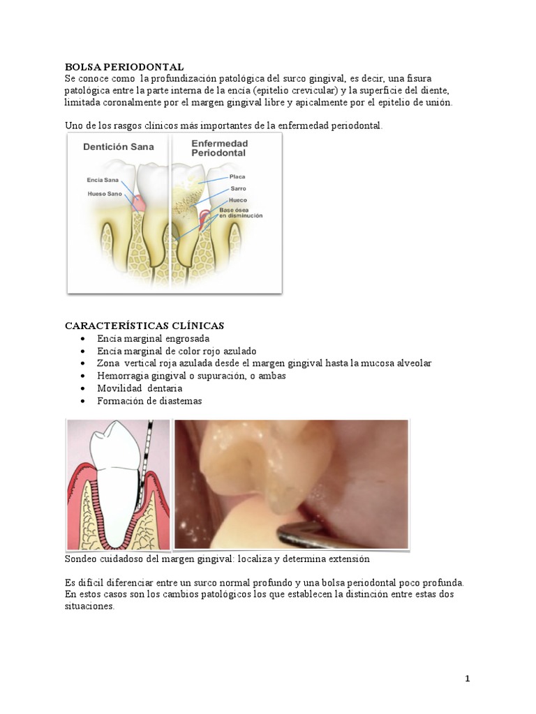 Bolsa Periodontal | PDF | Hueso | Ciencias de la Salud
