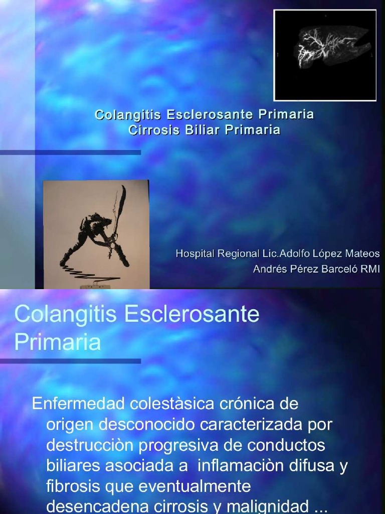 Colangitis Esclerosante Primaria 1 | PDF