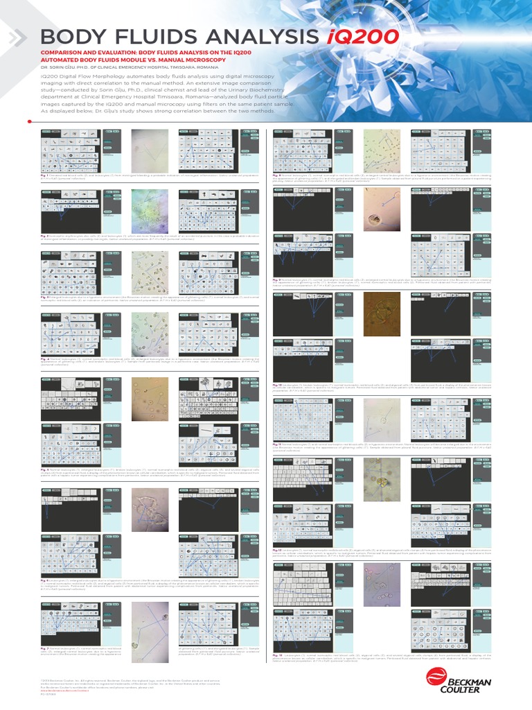 Body Fluids Urinalysis Poster EN | PDF | White Blood Cell | Peritoneum