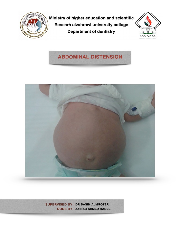 Abdominal Distension Supervised By Done By Pdf Bloating