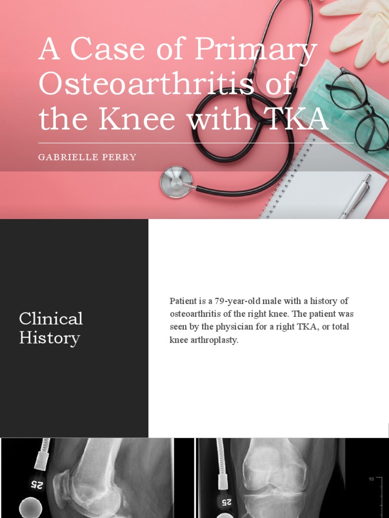 TKA Case Study | PDF | Osteoarthritis | Knee