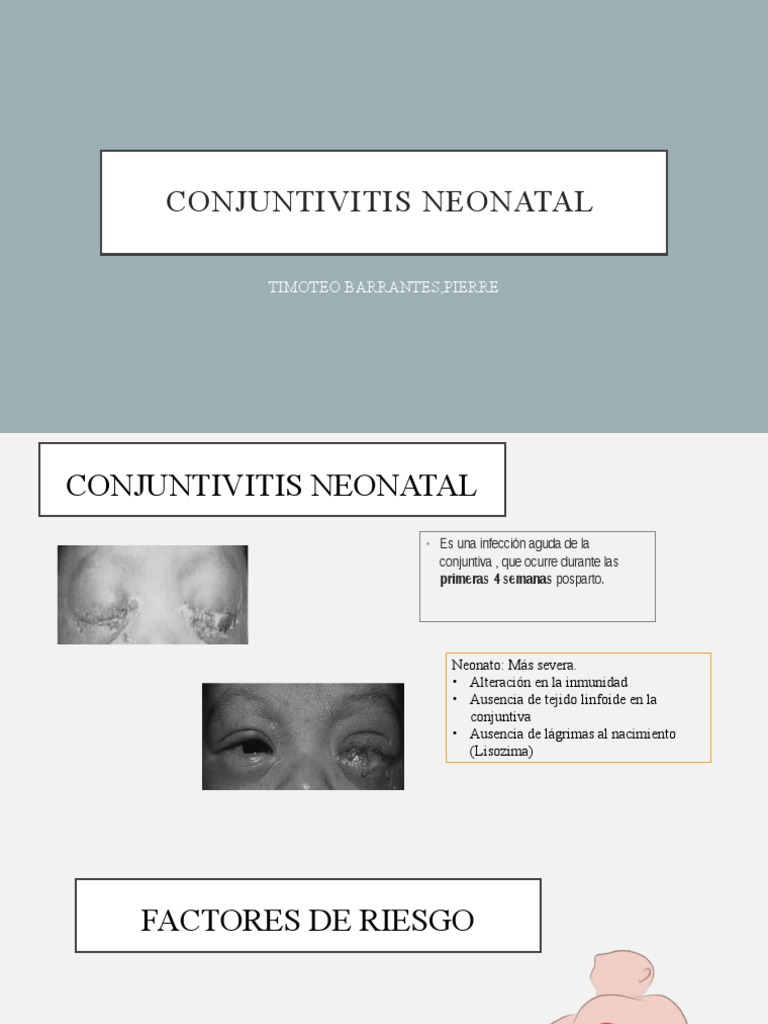 Conjuntivitis Neonatal 1 | PDF | Meningitis | Herpes Simple