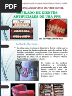 Pasos para El Enmuflado | PDF | Dentadura postiza | Odontología