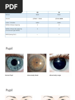 Pupil Isokor dan Anisokor: Penjelasan | PDF