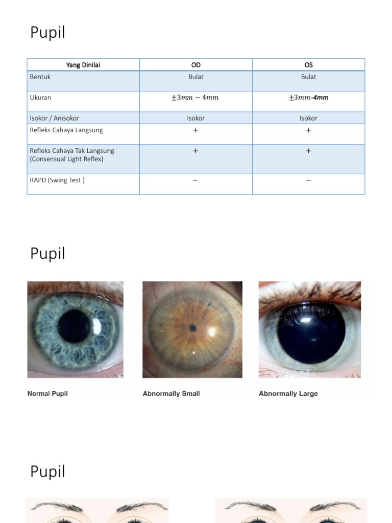 Ukuran dan Jenis Pupil Isokor | PDF | Sains & Matematika