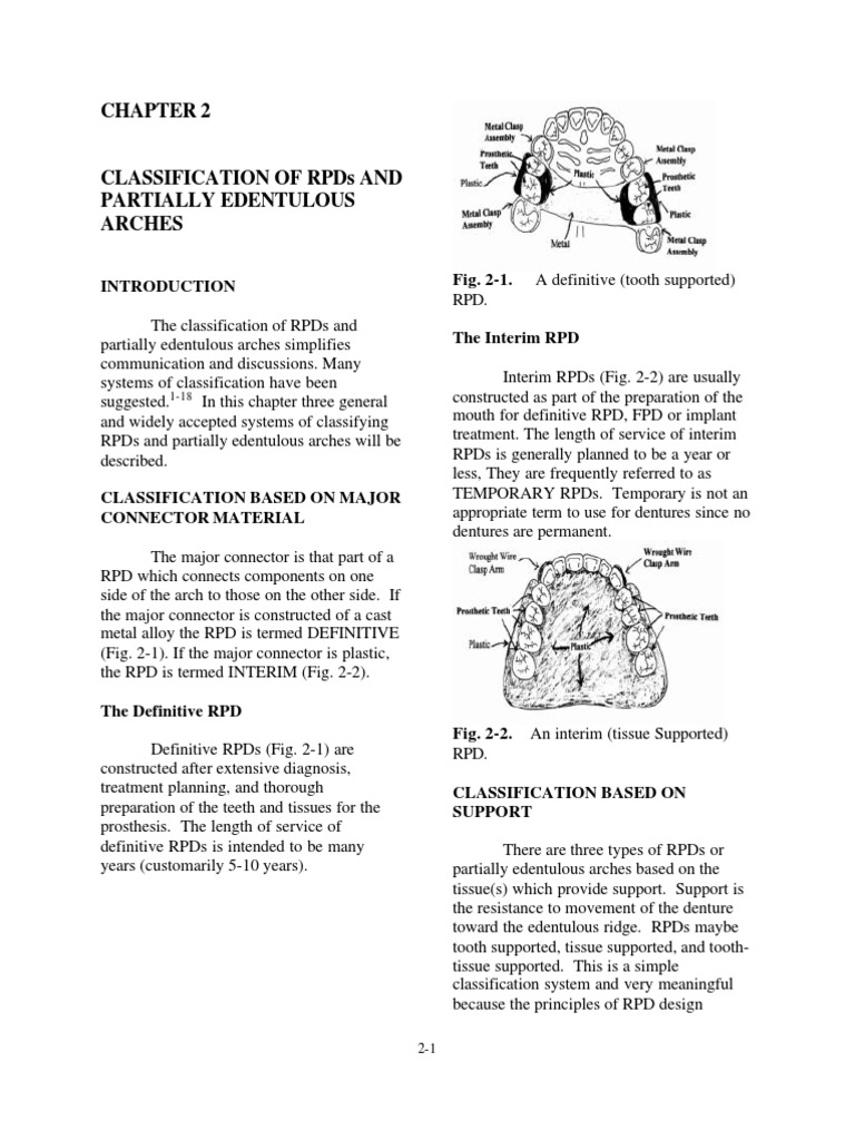 RPD Classification and Arch Types | PDF