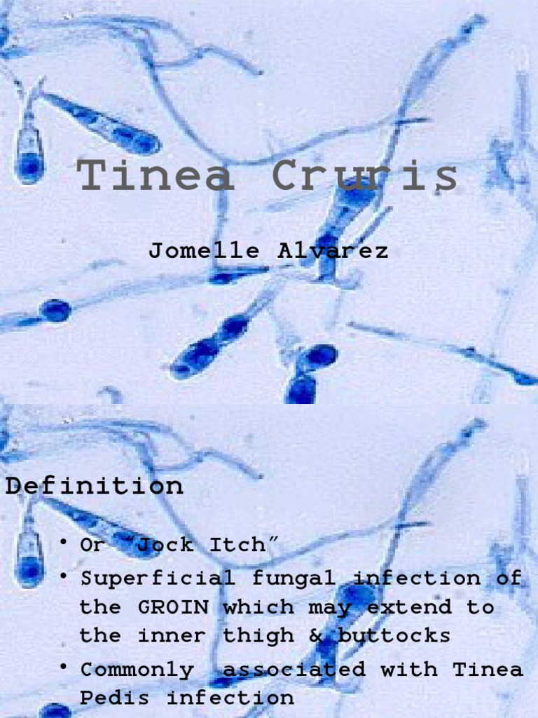 Tinea Cruris J | PDF