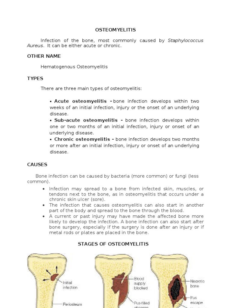 Osteomyelitis | Surgery | Infection