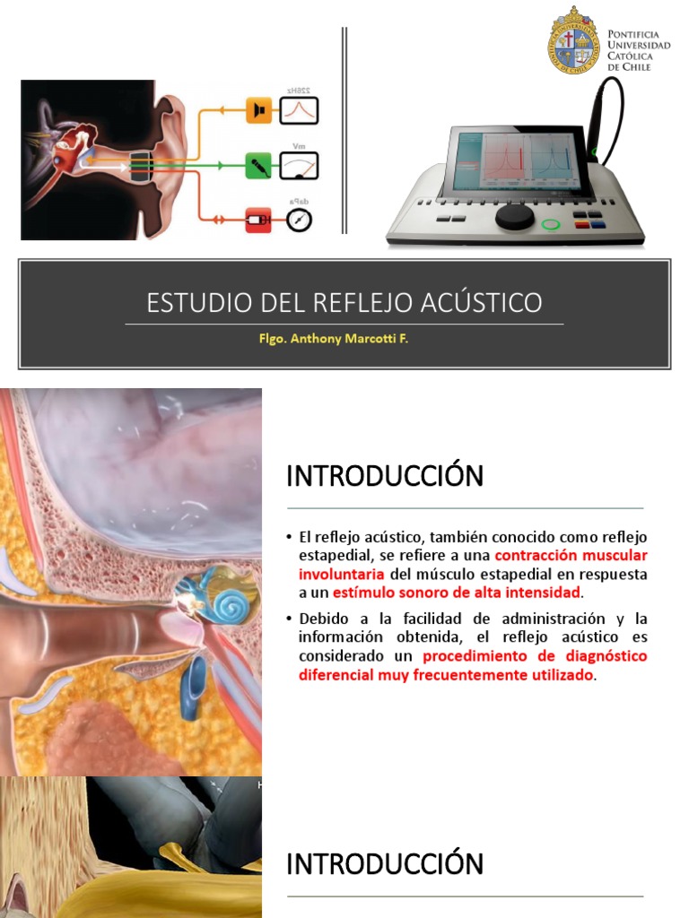 Reflejo+Acústico+ Audiología+2017 | PDF | Decibel | Oído