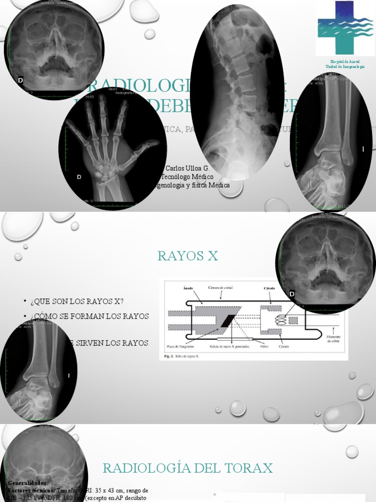 Posiciones Radiológicas en Rayos X | PDF | La columna vertebral | Vértebra